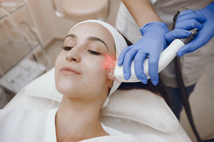 RF Micro-Needling Service - The Skin Institute