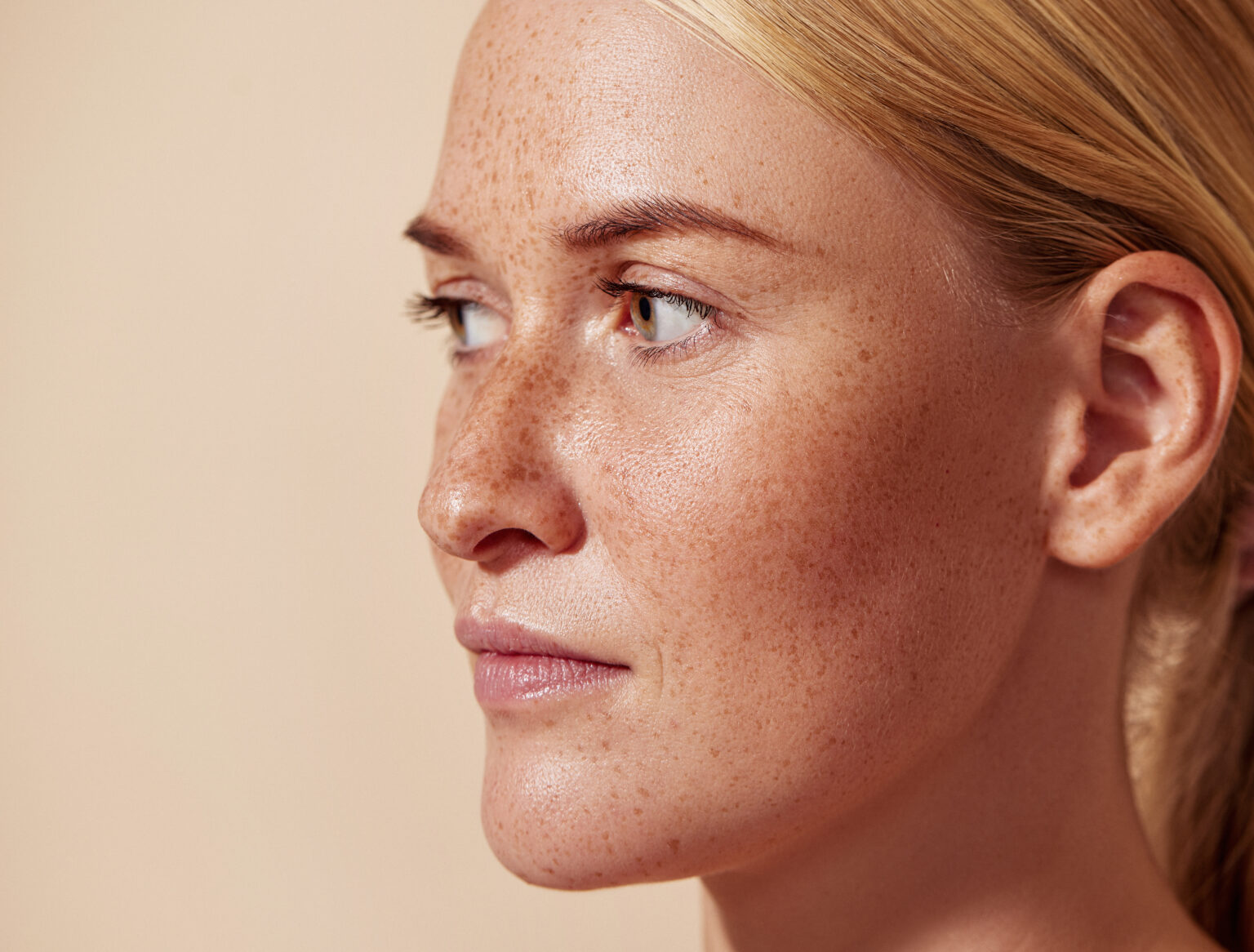 Pigmentation Treatment in Abu Dhabi | Pigmentation treatments